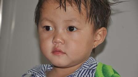 Run rẩy trước hình ảnh bé 2 tuổi đáng yêu sắp bị… khoét mắt